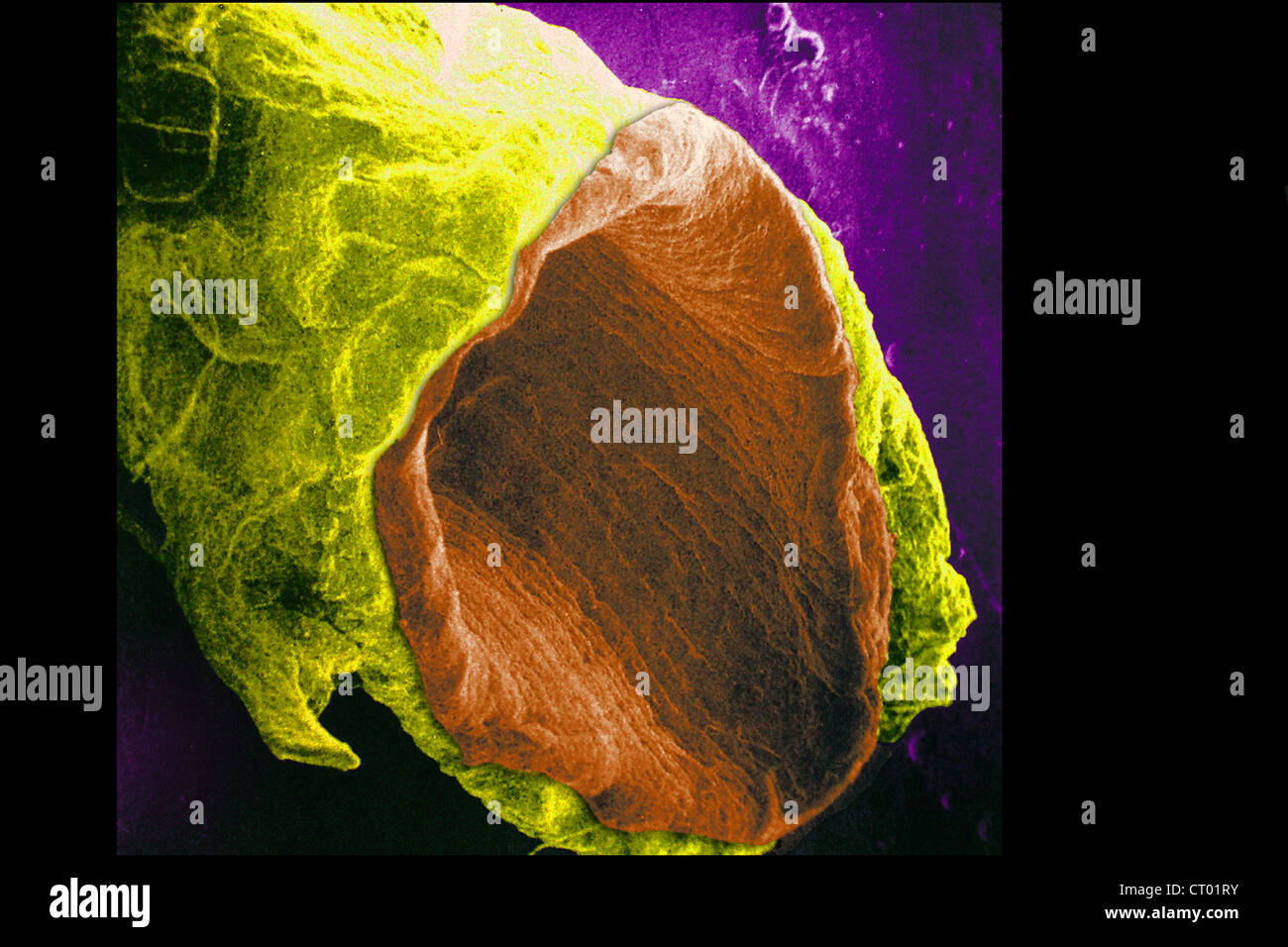 Electron microscopy vein hi-res stock photography and images - Alamy