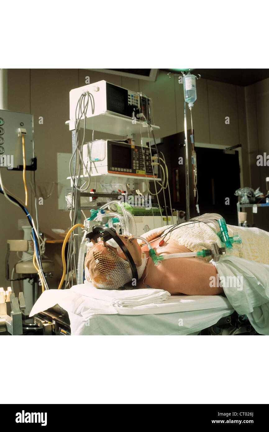 Stereotactic brain surgery hi-res stock photography and images - Alamy