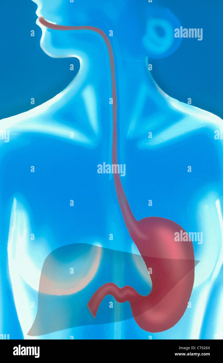 Woman stomach drawing not pregnant hi-res stock photography and images ...