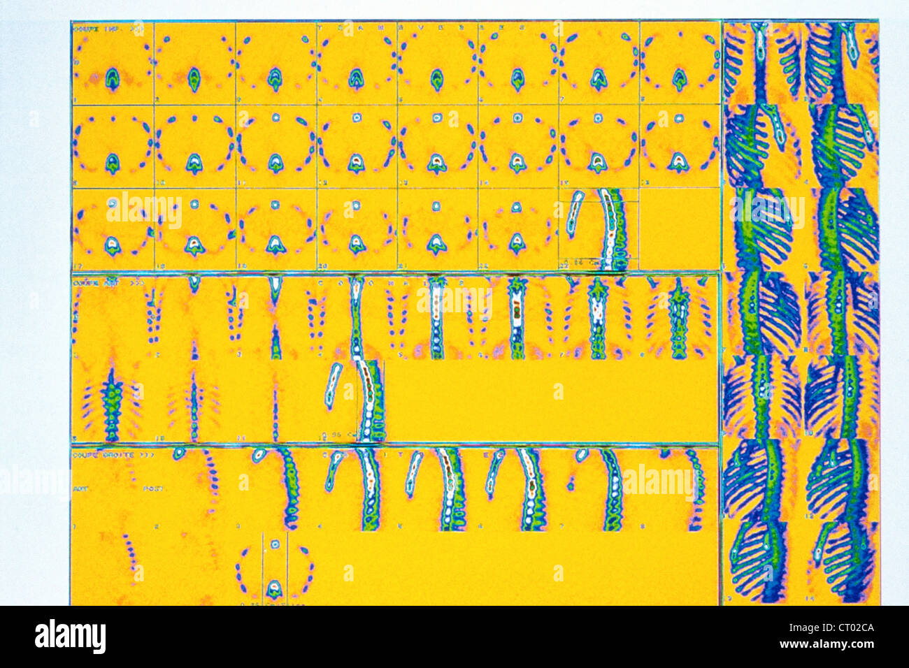 Scintiscanner Stock Photos & Scintiscanner Stock Images - Alamy