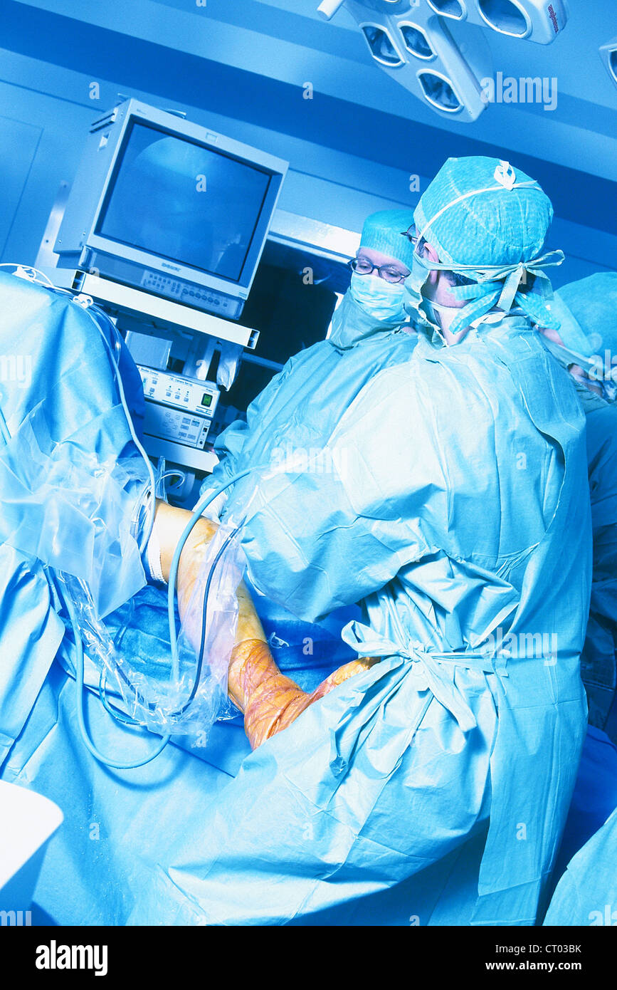Knee arthroscopy hi-res stock photography and images - Alamy