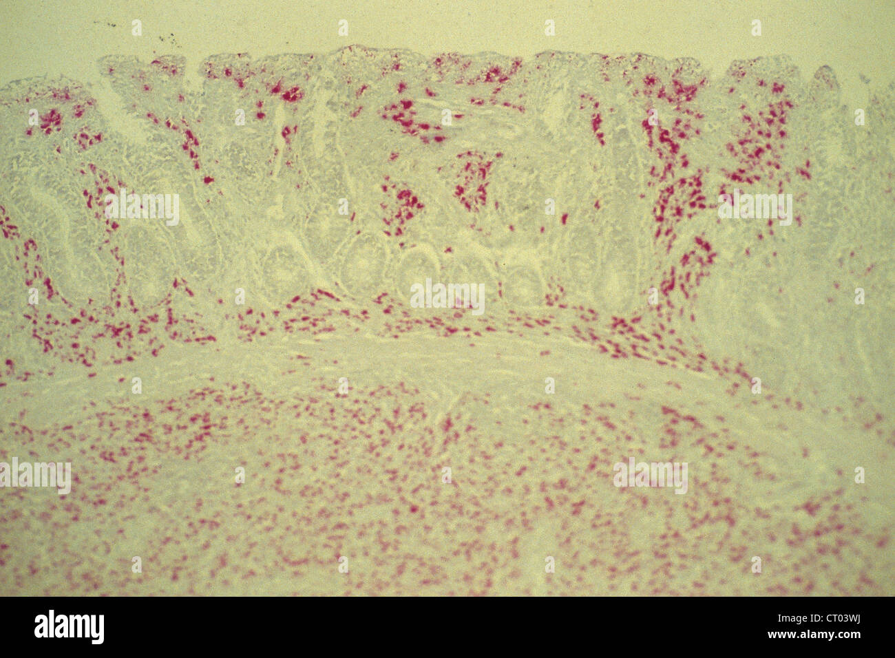 Johnes hi-res stock photography and images - Alamy