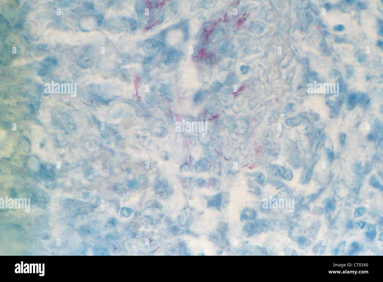 Bovine tuberculosis hi-res stock photography and images - Alamy