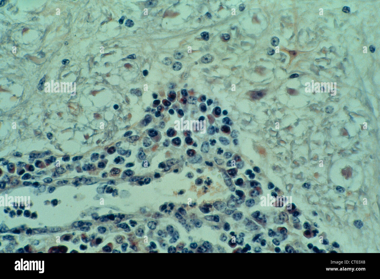 Listeriosis hi-res stock photography and images - Alamy