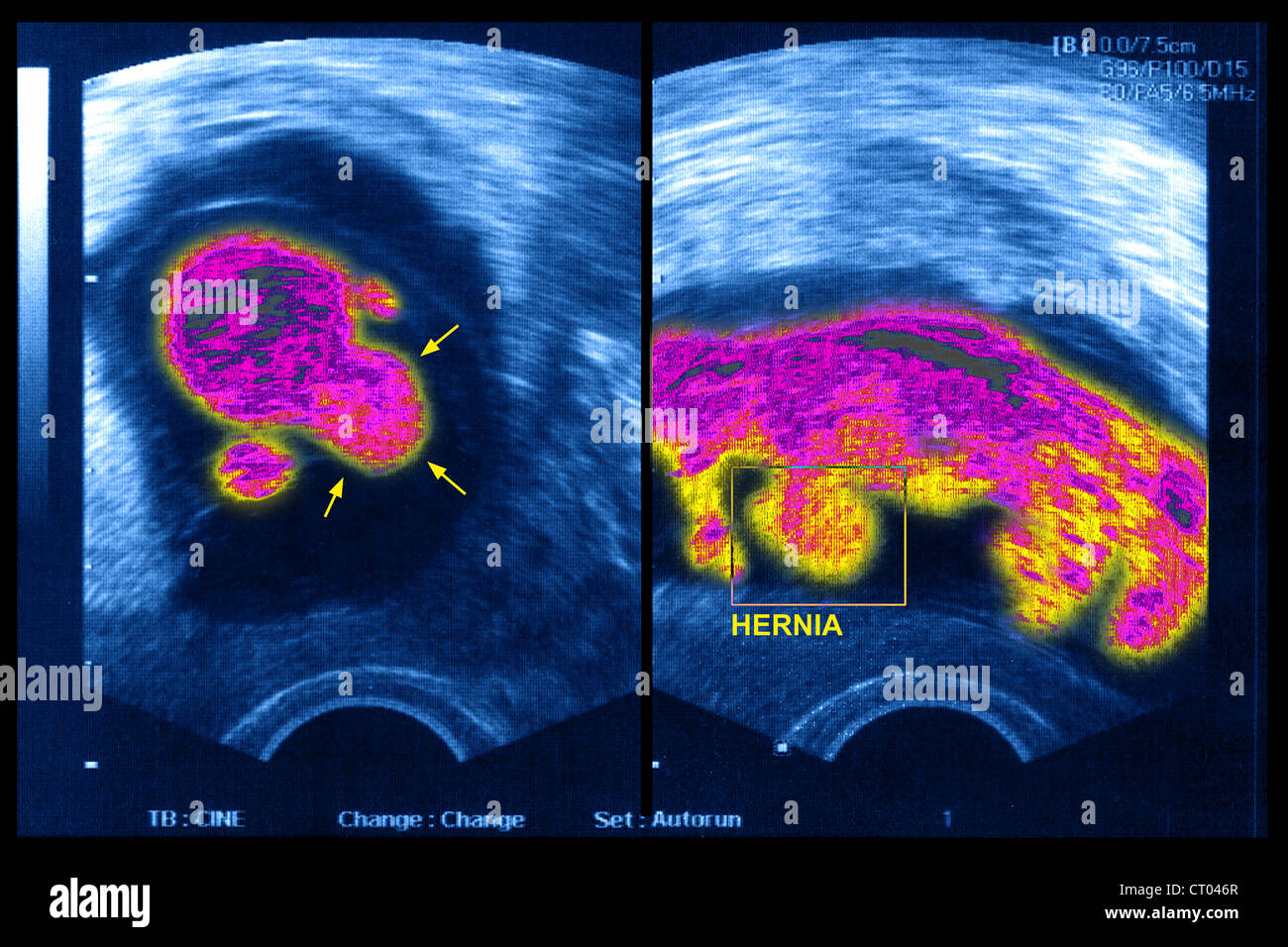 Umbilicus hi-res stock photography and images - Alamy
