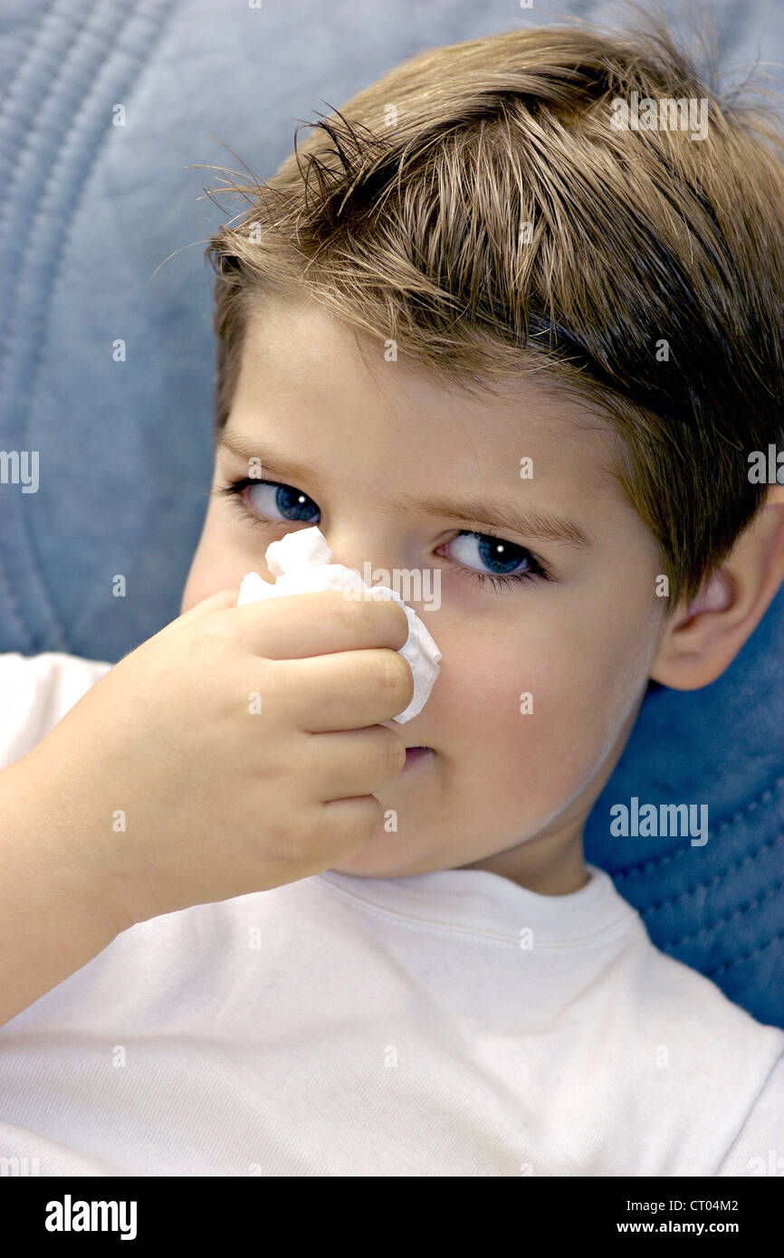 CHILD WITH RHINITIS Stock Photo - Alamy