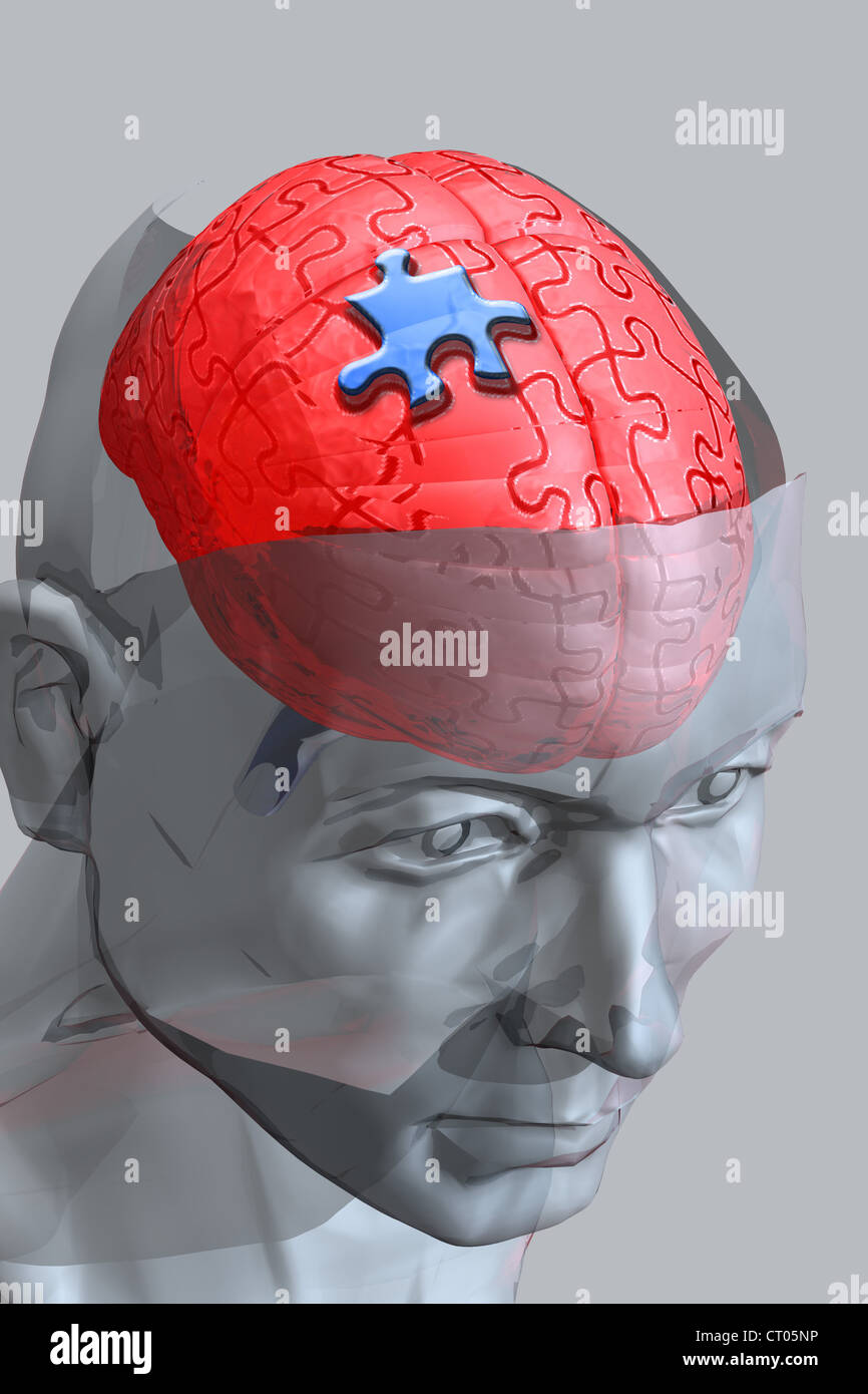 Neuron death hi-res stock photography and images - Alamy