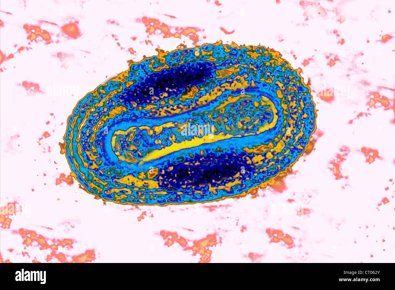 Smallpox virus microscope hi-res stock photography and images - Alamy