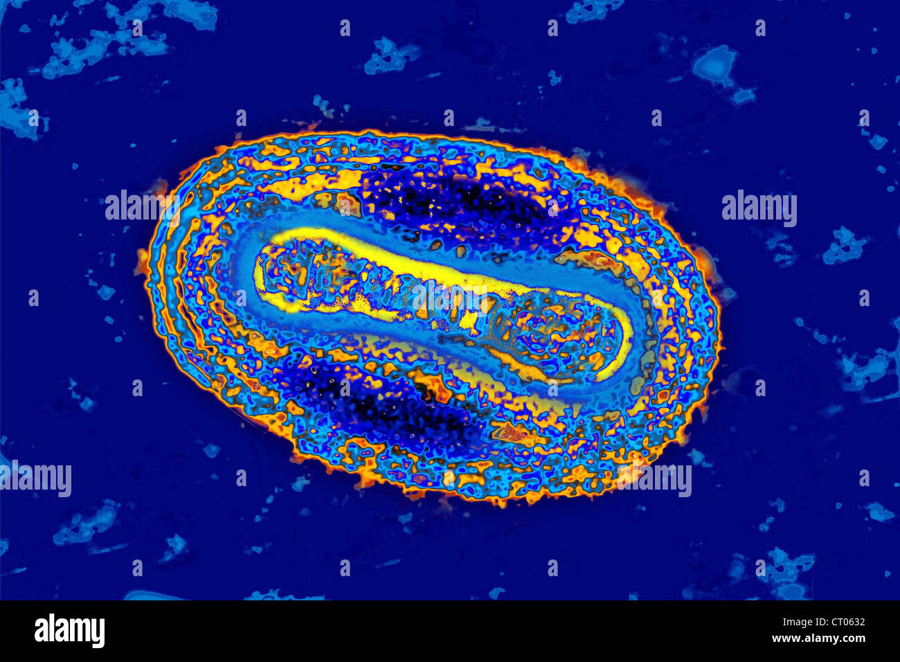 Smallpox virus microscope hi-res stock photography and images - Alamy