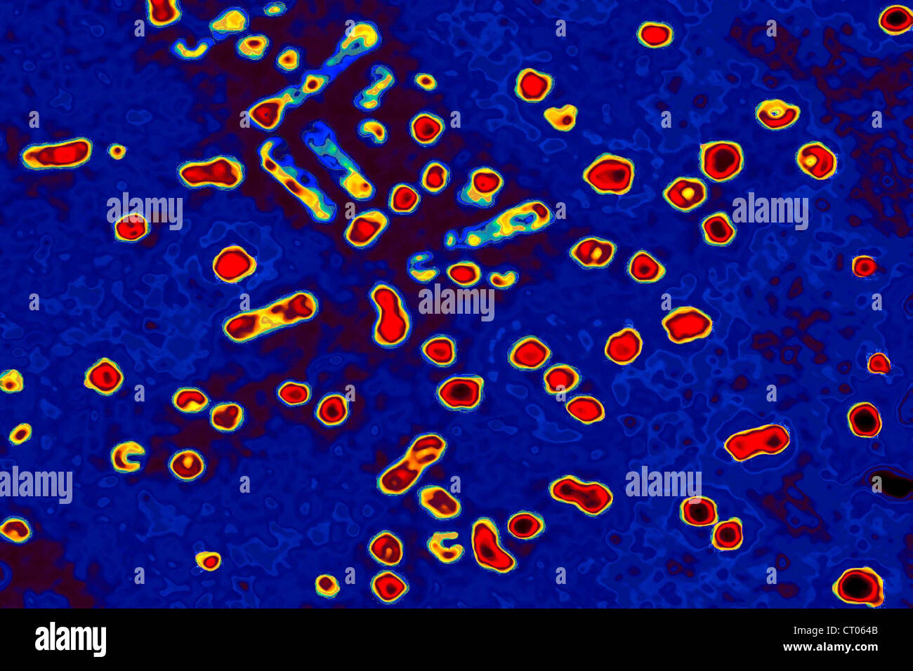 Hepadnaviruses hi-res stock photography and images - Alamy