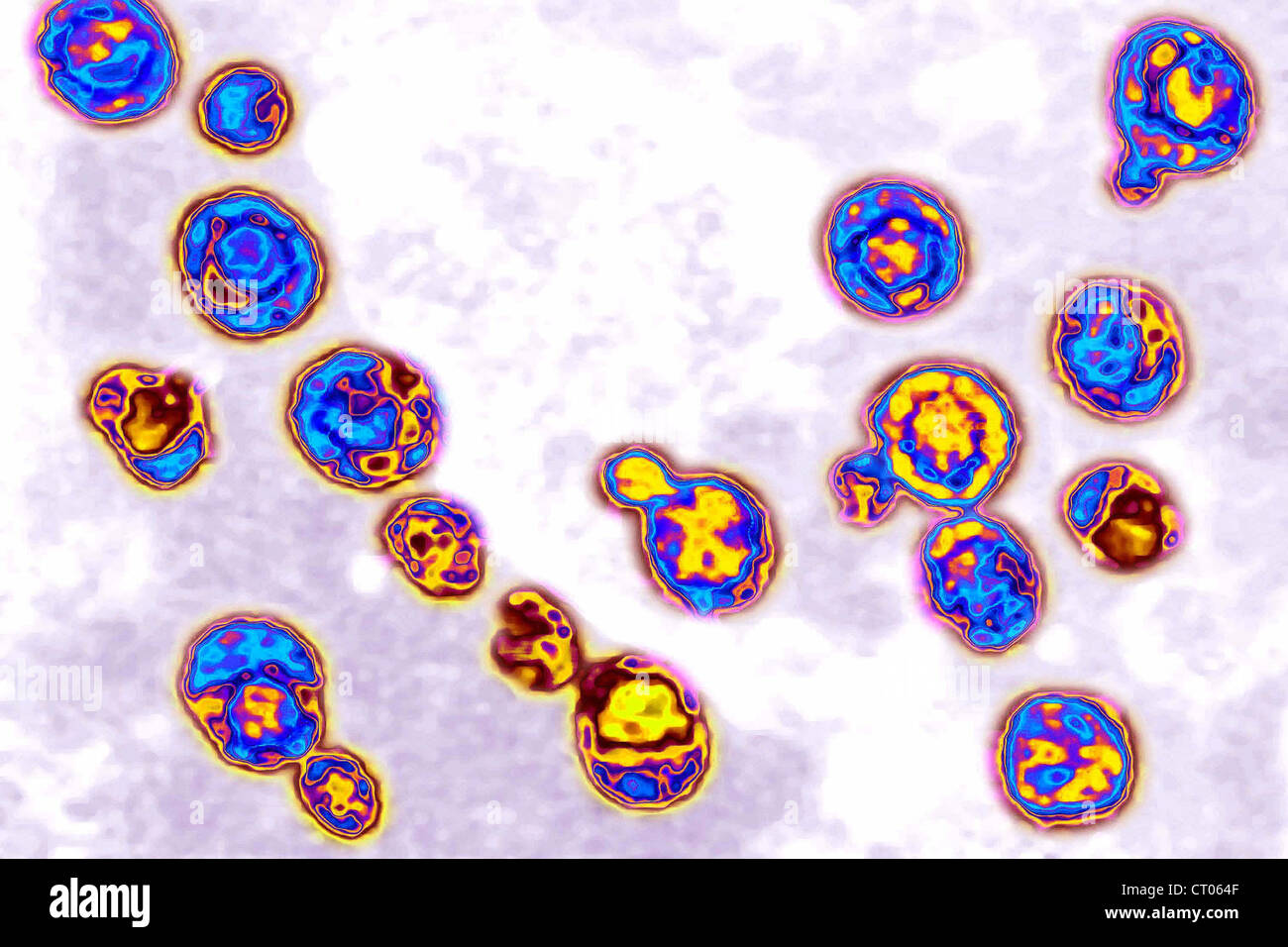 HERPES SIMPLEX VIRUS Stock Photo - Alamy