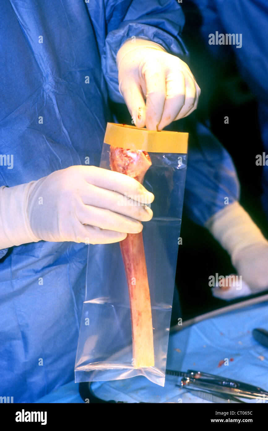 Bone graft clean hi-res stock photography and images - Alamy