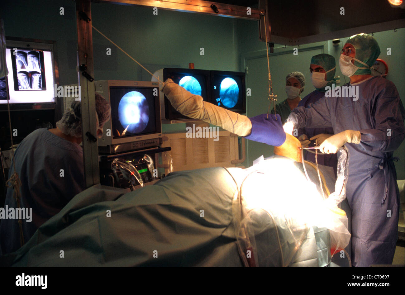 Shoulder arthroscopy hi-res stock photography and images - Alamy