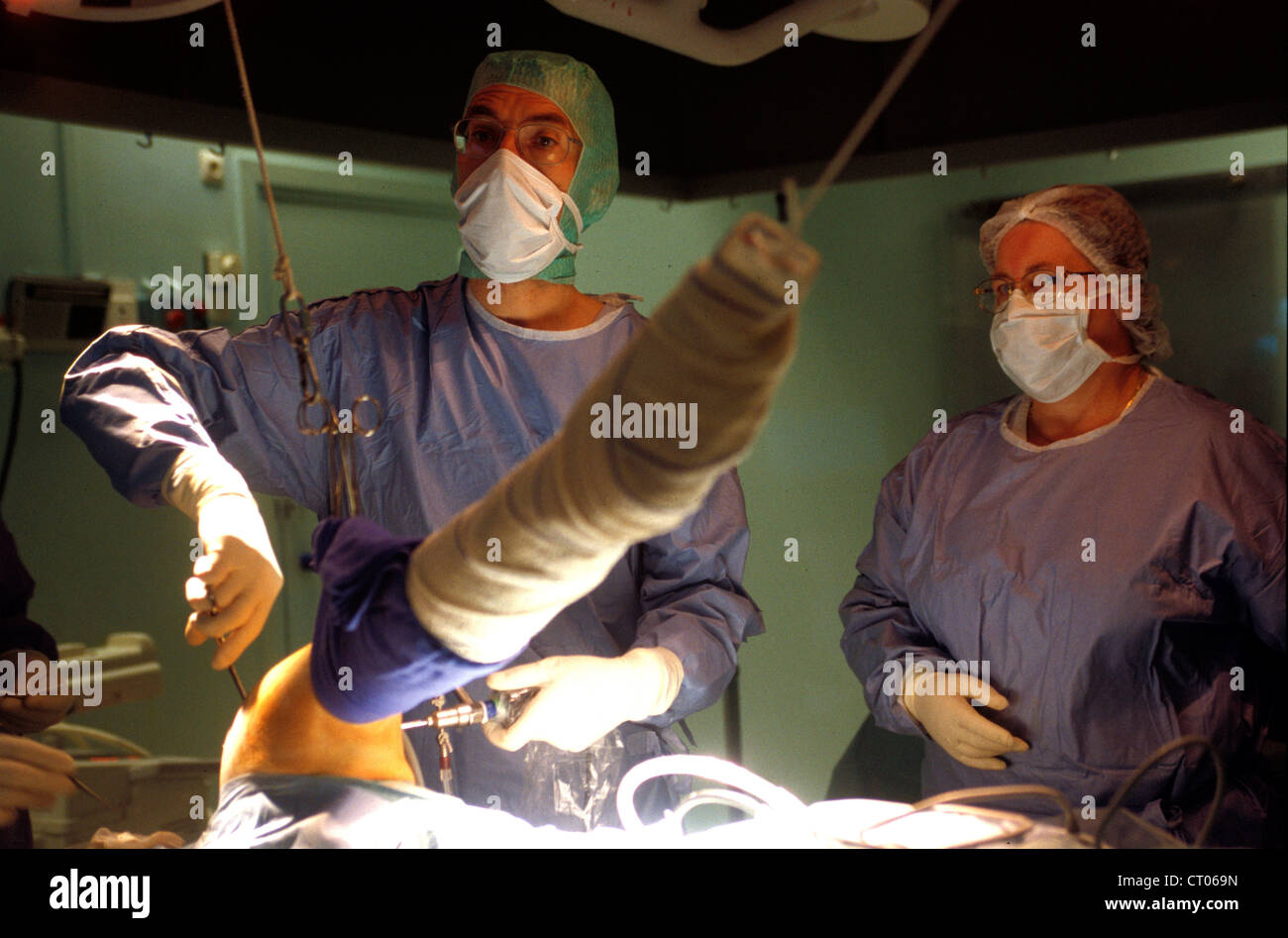 Shoulder joint endoscopy hi-res stock photography and images - Alamy