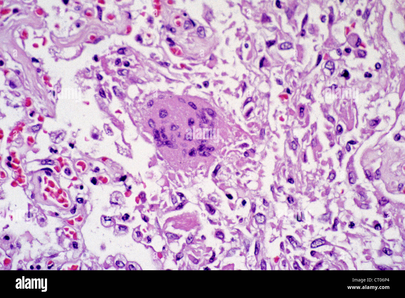 Histology lung micrograph hi-res stock photography and images - Alamy