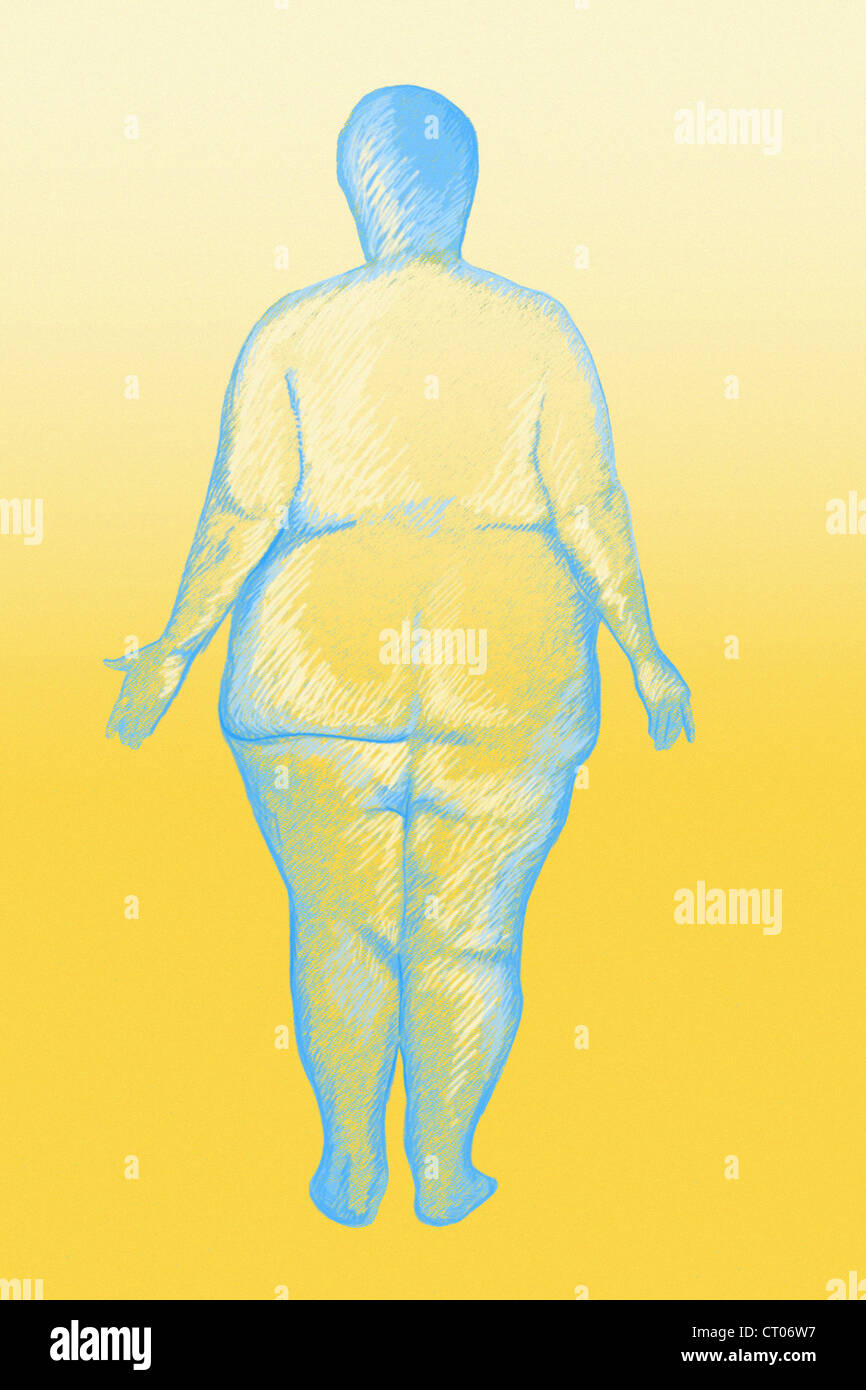 OBESE WOMAN, ILLUSTRATION Stock Photo - Alamy