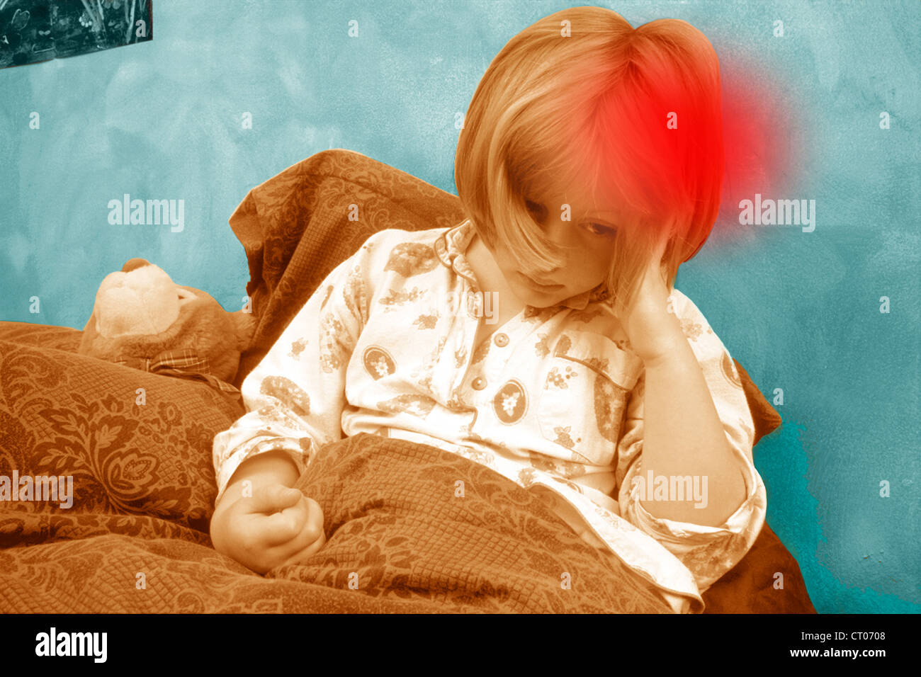FEVER IN A CHILD Stock Photo - Alamy