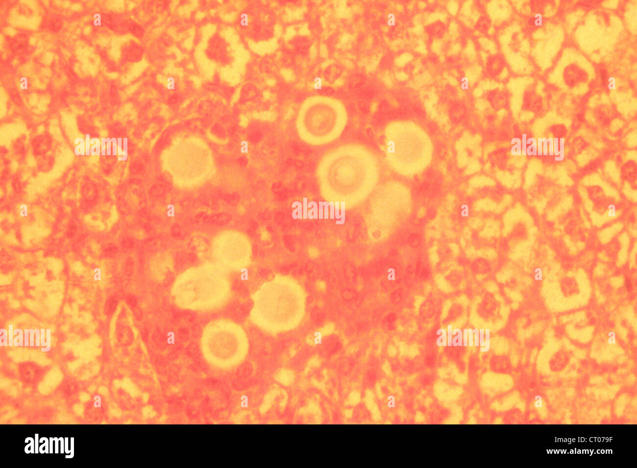 Cryptococcus hi-res stock photography and images - Alamy