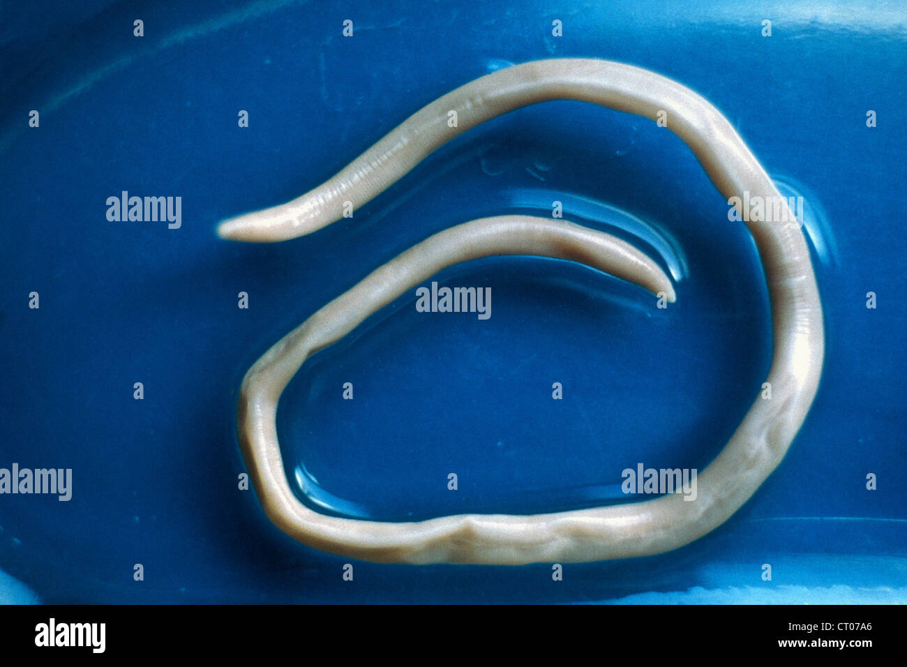 Ascariasis Stock Photos & Ascariasis Stock Images - Alamy