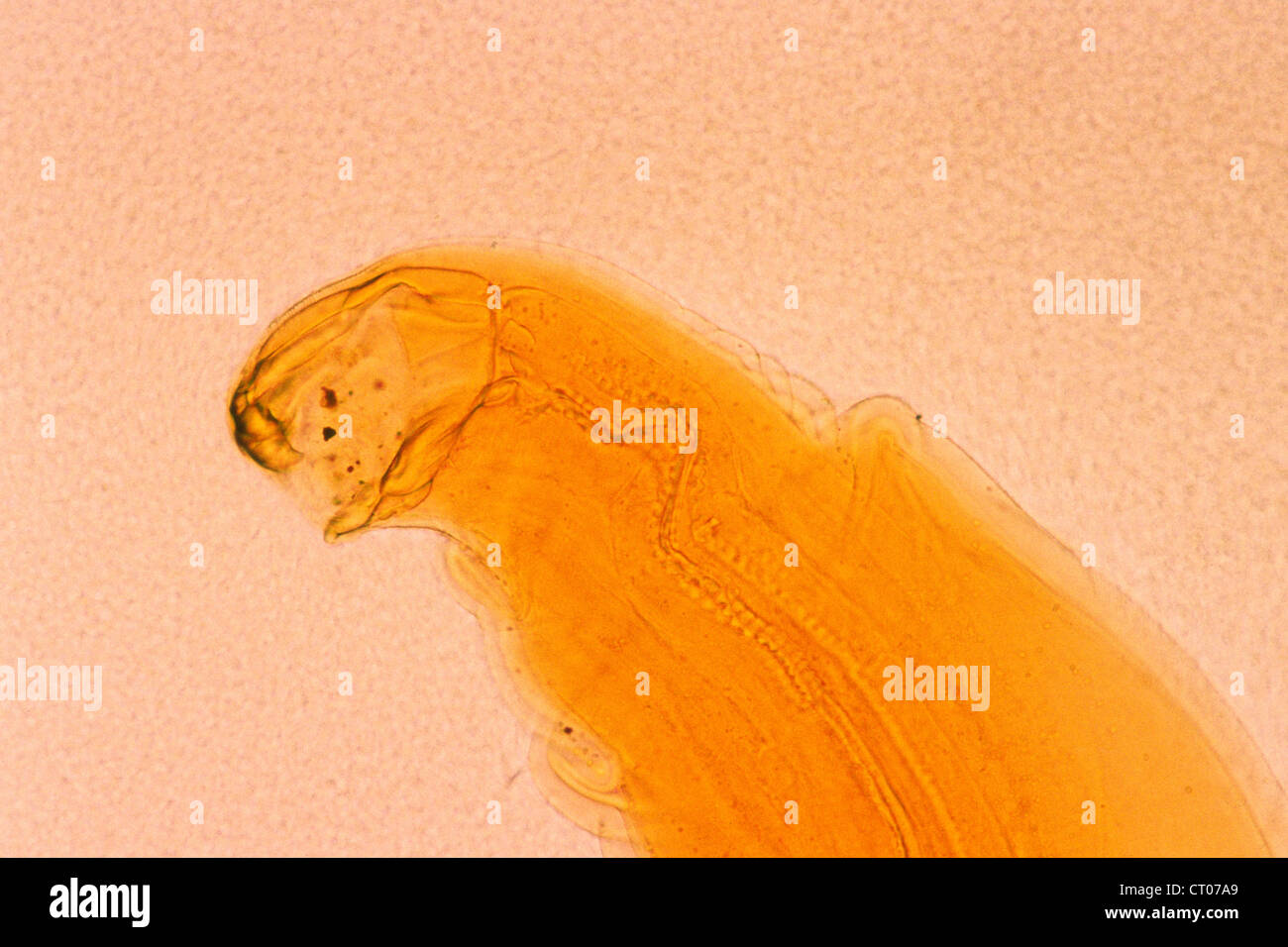 Hookworm hi-res stock photography and images - Alamy