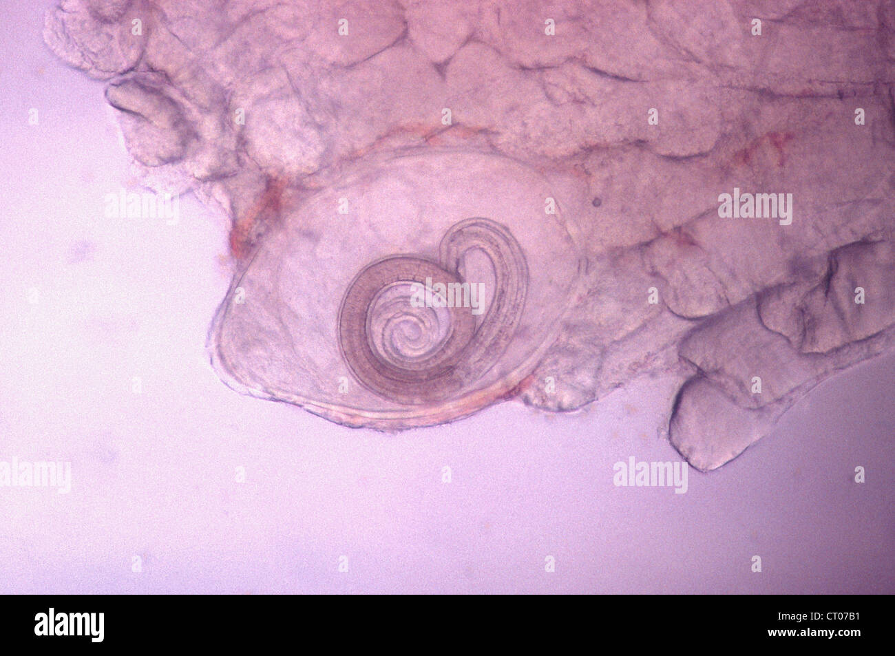 Trichinella spiralis hi-res stock photography and images - Alamy