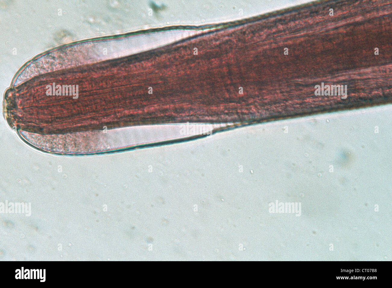 Pinworm hi-res stock photography and images - Alamy