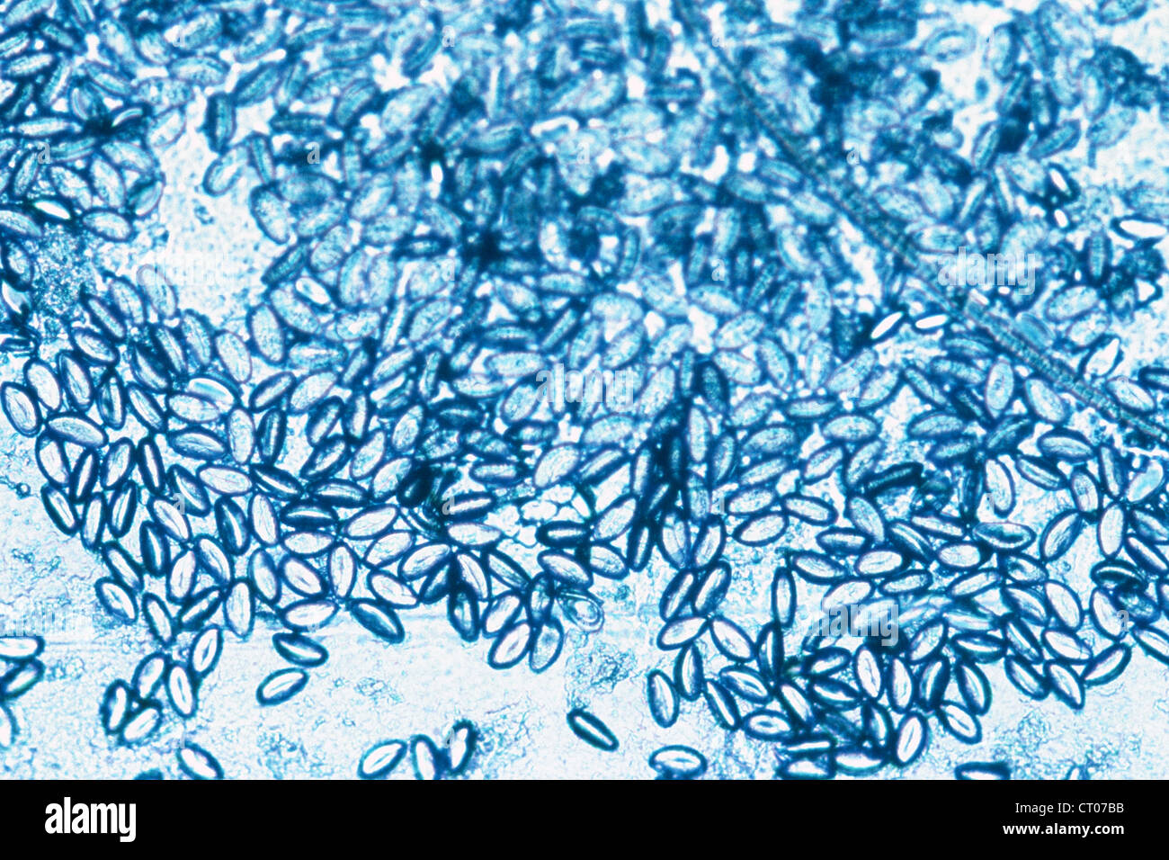 Pinworms hi-res stock photography and images - Alamy