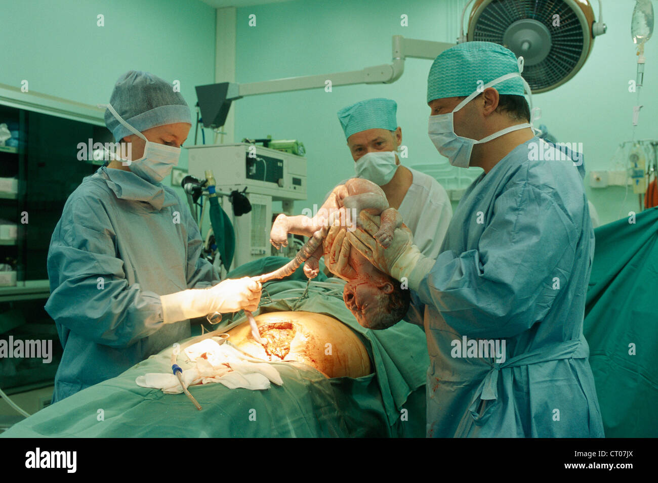 Caesarian section hi-res stock photography and images - Alamy