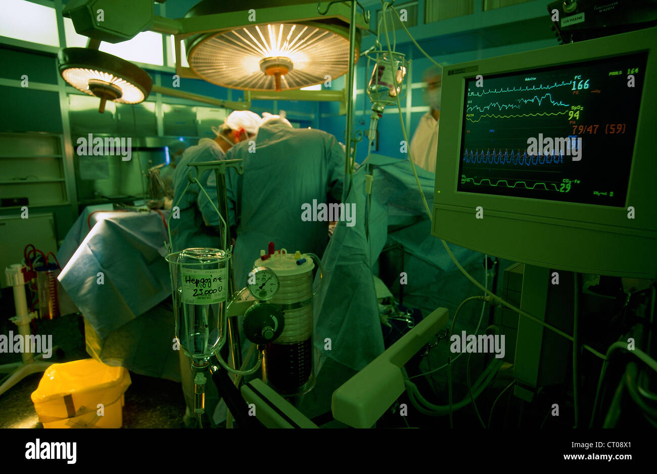 Aortic valve surgery hi-res stock photography and images - Alamy