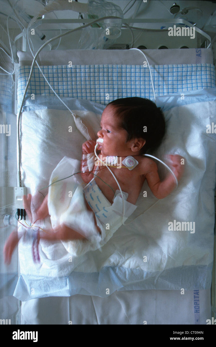 Premature feeding hi-res stock photography and images - Alamy