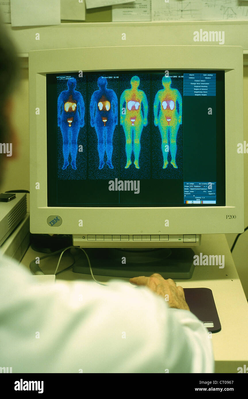 Gamma scanners hi-res stock photography and images - Alamy