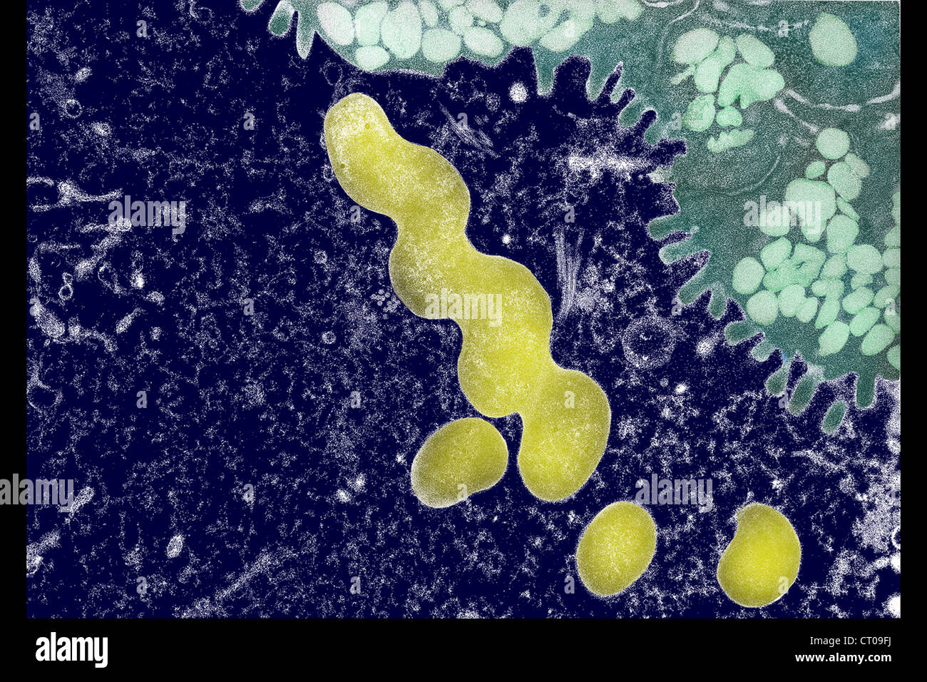 Helicobacter test hi-res stock photography and images - Alamy