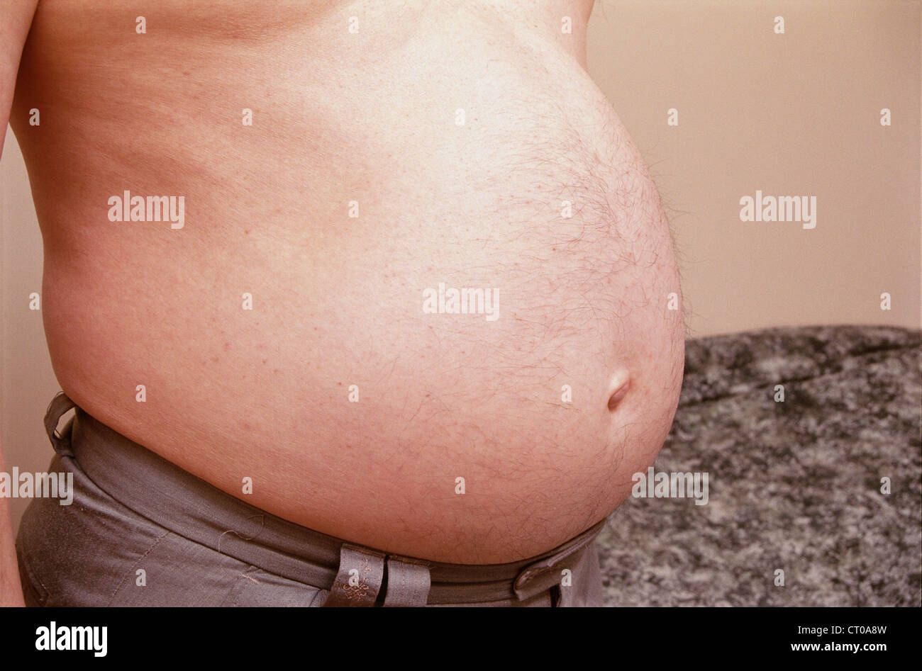 Enormous Abdomen High Resolution Stock Photography and Images - Alamy