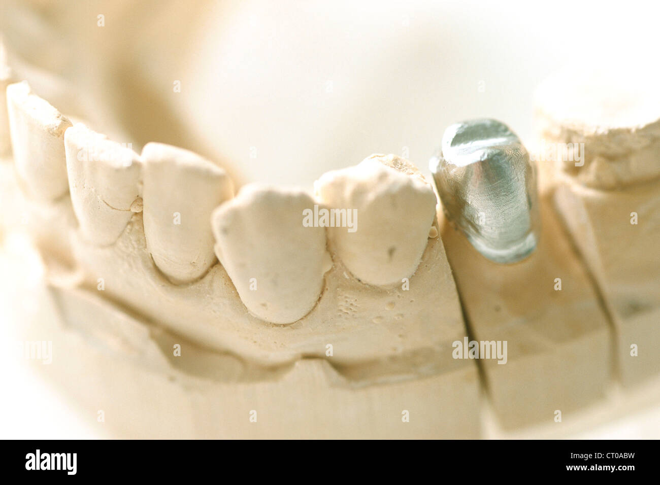 Tooth imprint hi-res stock photography and images - Alamy