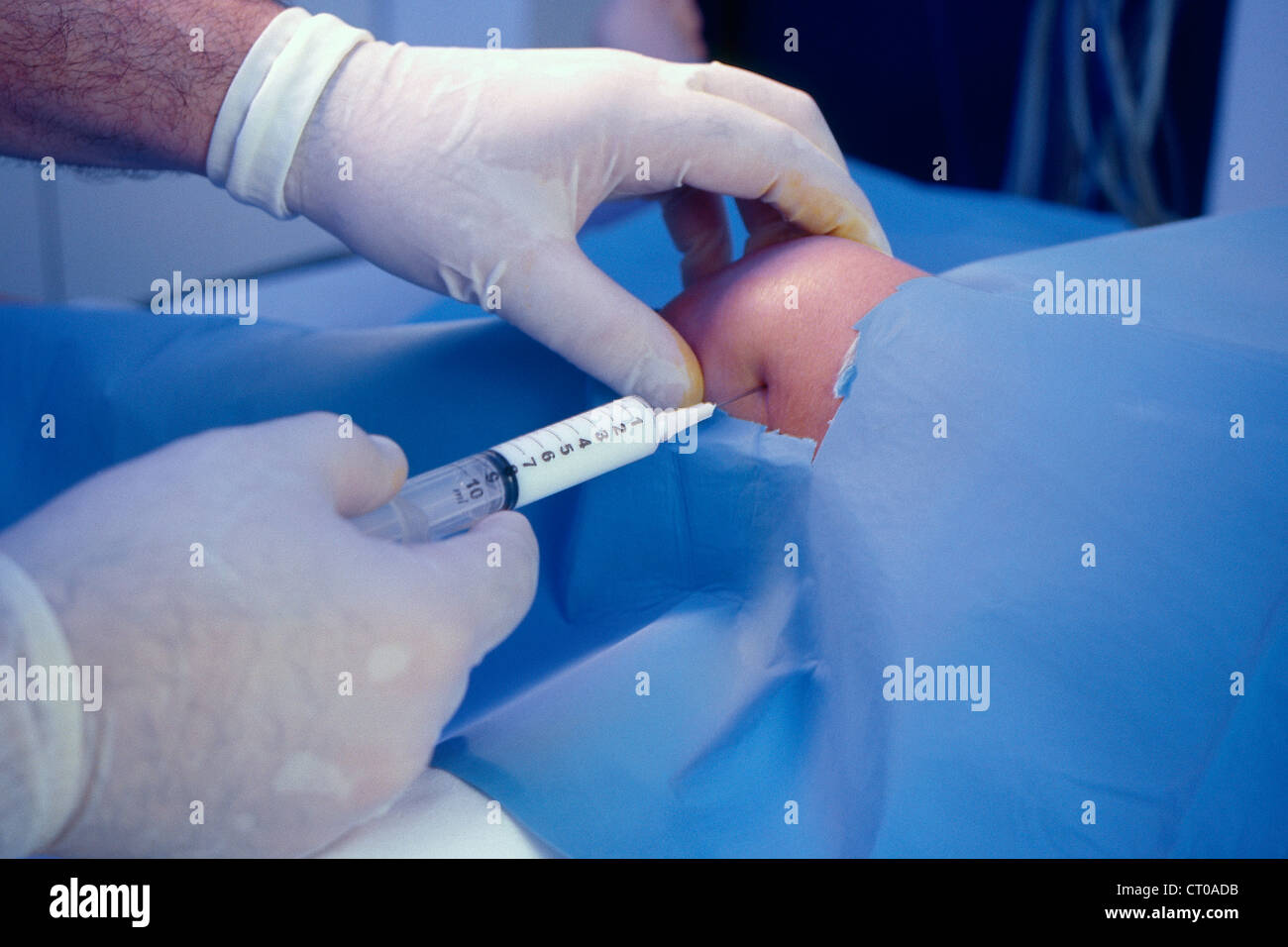 Intra muscular hi-res stock photography and images - Alamy