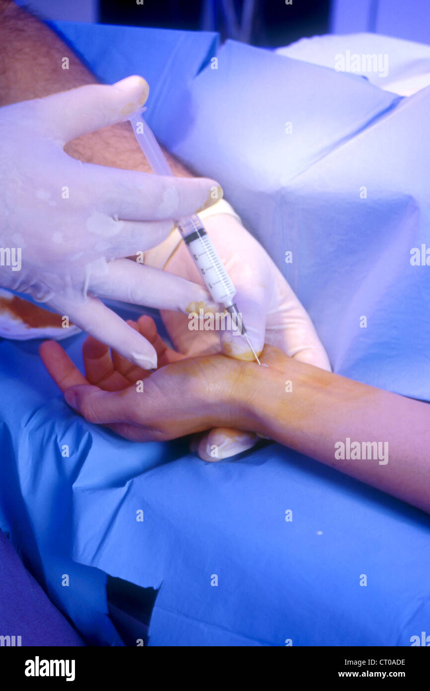 Wrist gloves hi-res stock photography and images - Alamy