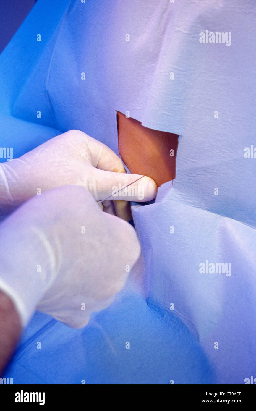 Lumbar puncture hi-res stock photography and images - Alamy