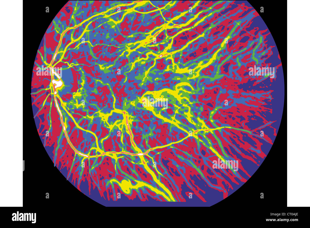 Retinal Photography Stock Photos & Retinal Photography Stock Images - Alamy