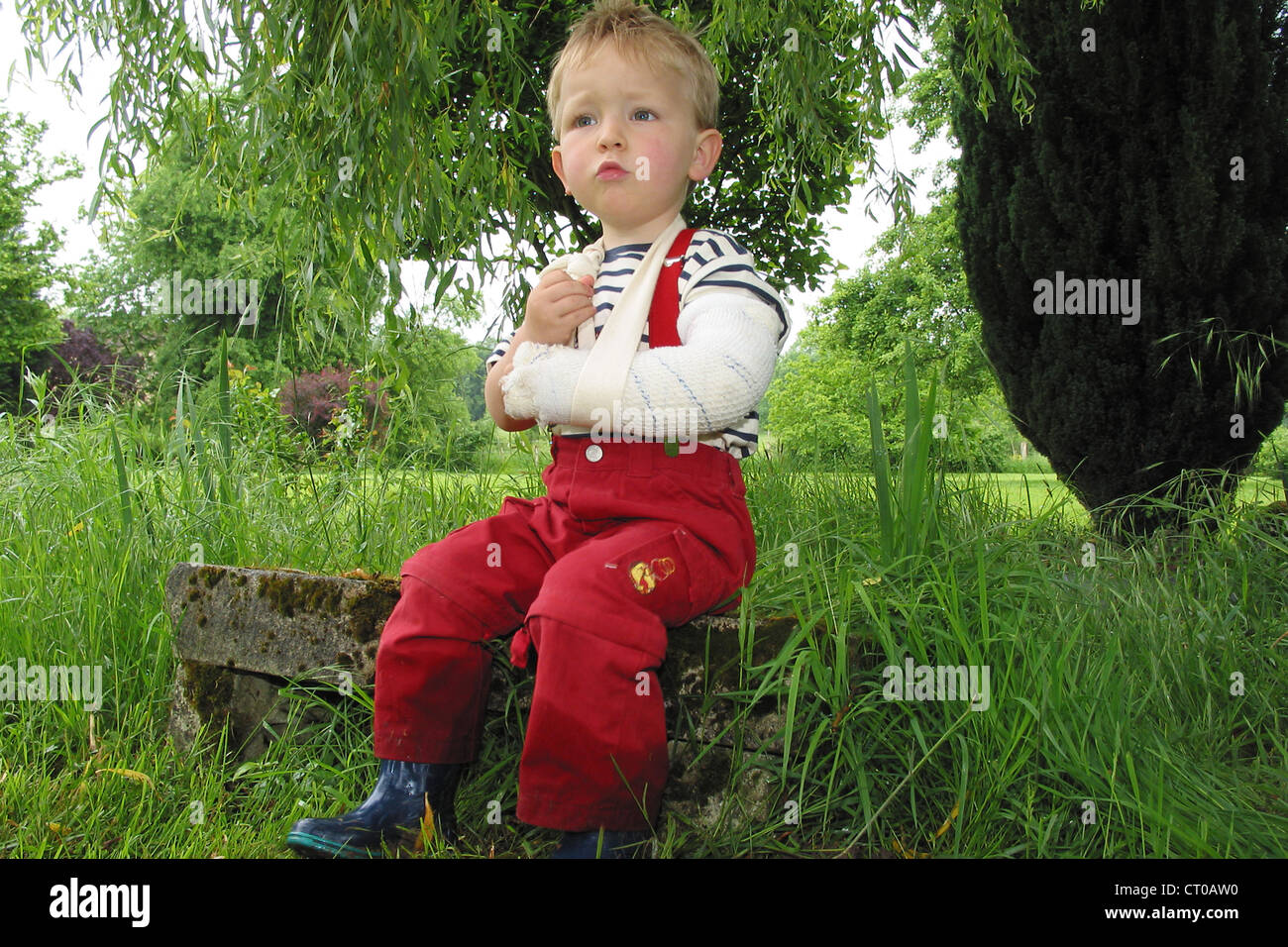 Skeletal cast hi-res stock photography and images - Alamy