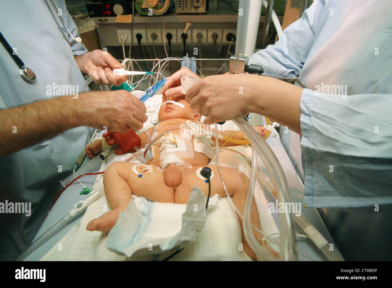 Icu infant hi-res stock photography and images - Alamy