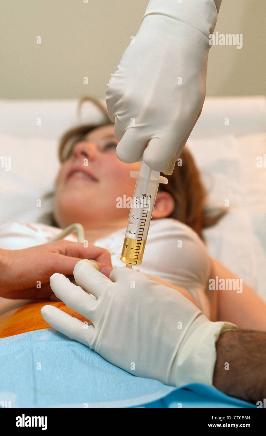 Amniocentesis medical hospital hi-res stock photography and images - Alamy