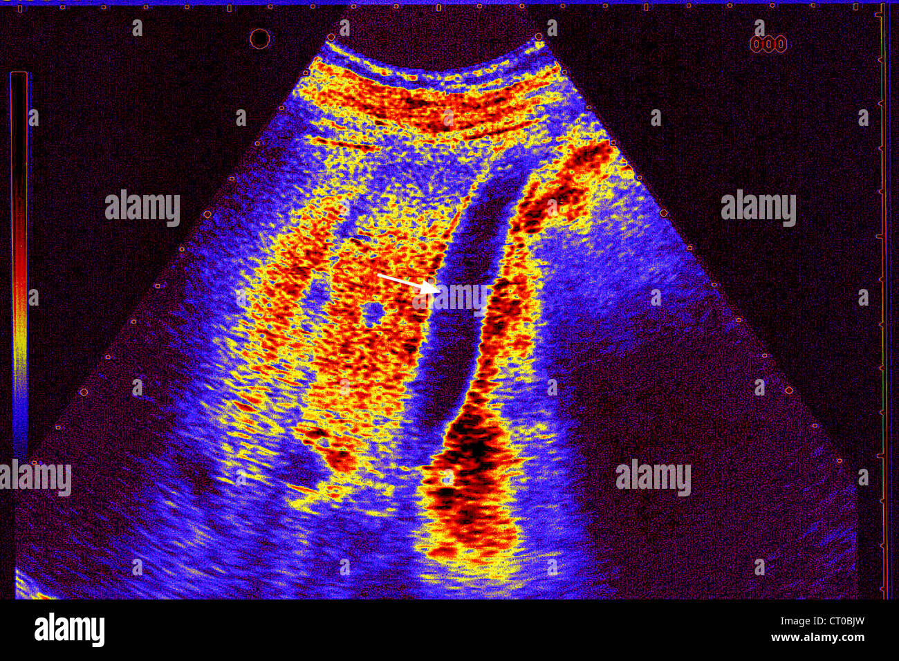 Gallbladder examination hi-res stock photography and images - Alamy
