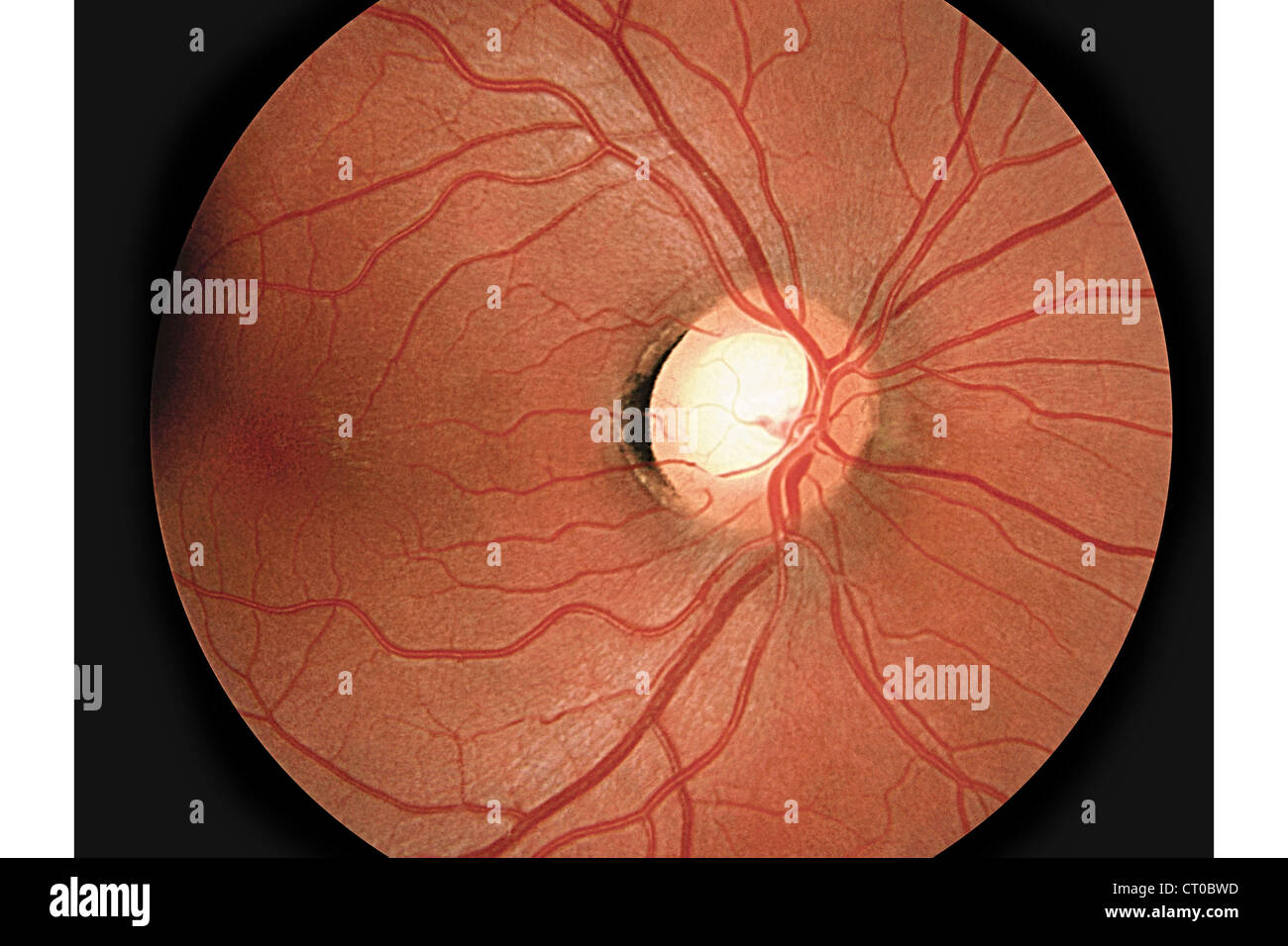 Retinography hi-res stock photography and images - Alamy