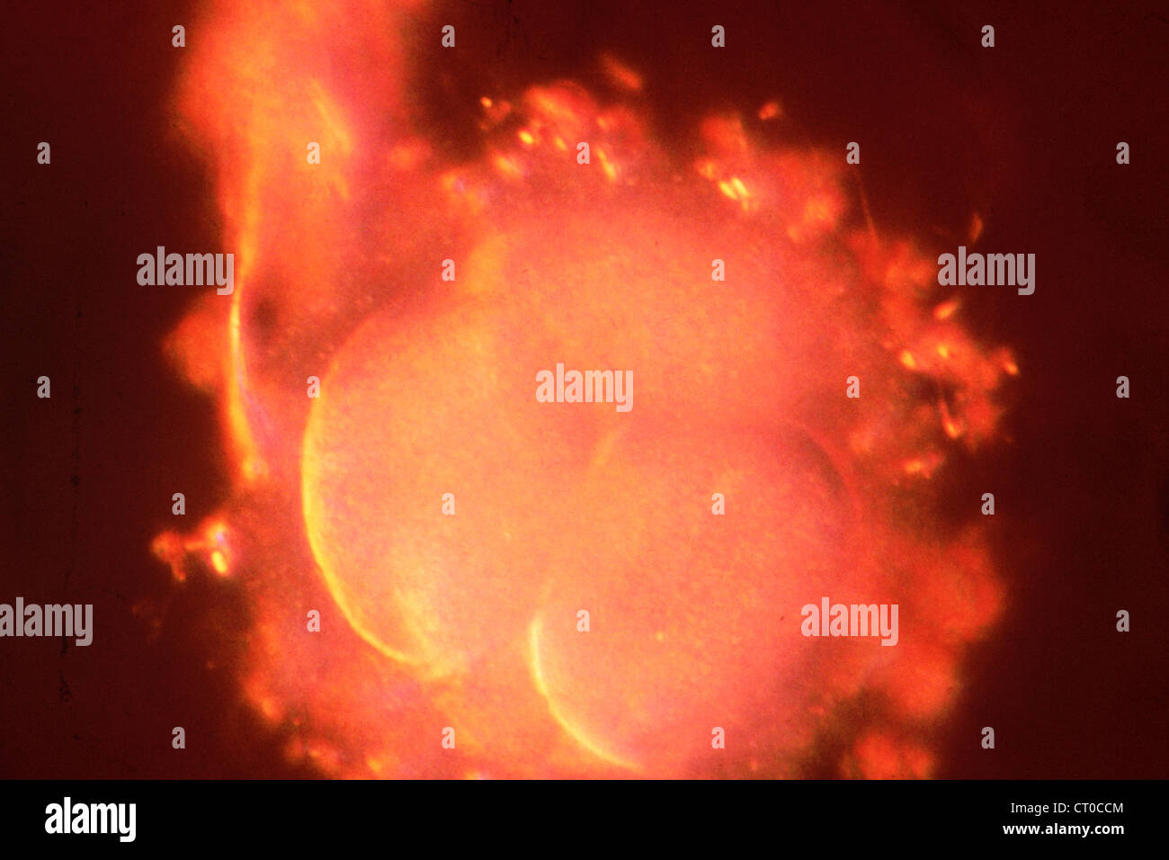 Human embryo micrograph hi-res stock photography and images - Alamy