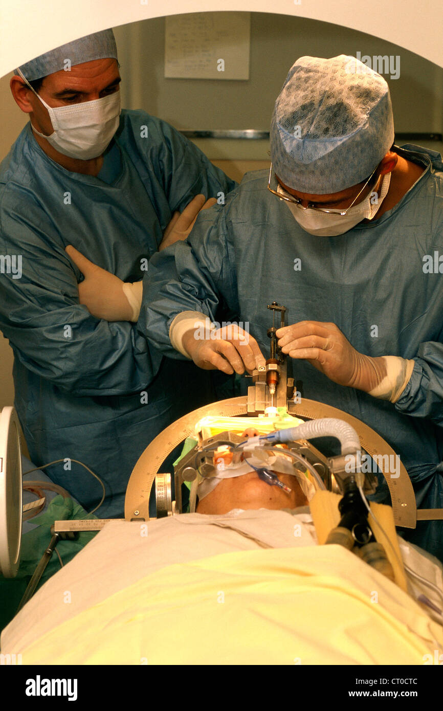 Stereotactic brain surgery hi-res stock photography and images - Alamy