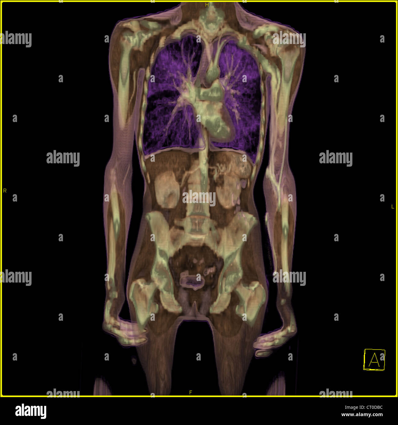 Three skeletal structures hi-res stock photography and images - Alamy