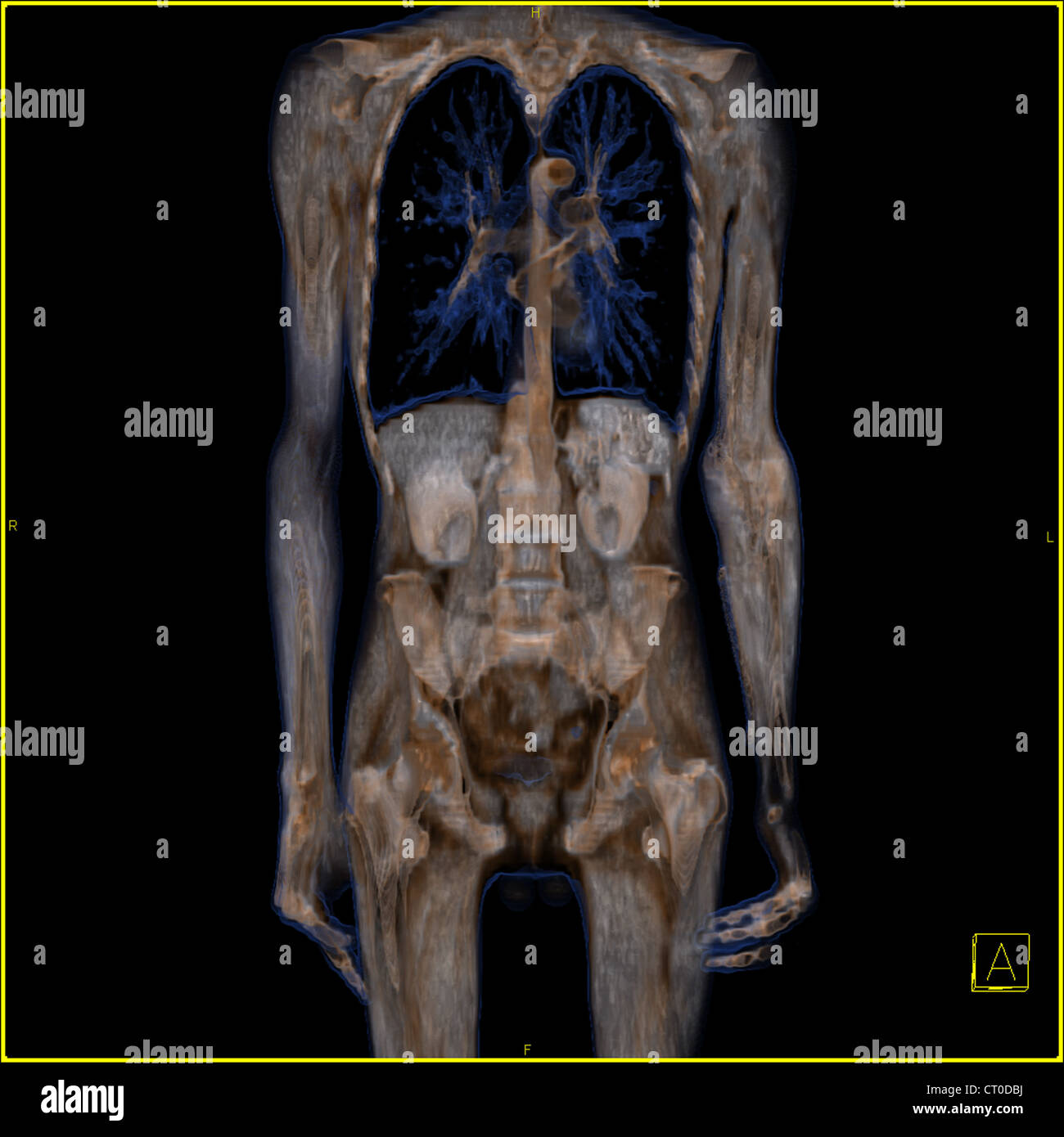 Three skeletal structures hi-res stock photography and images - Alamy