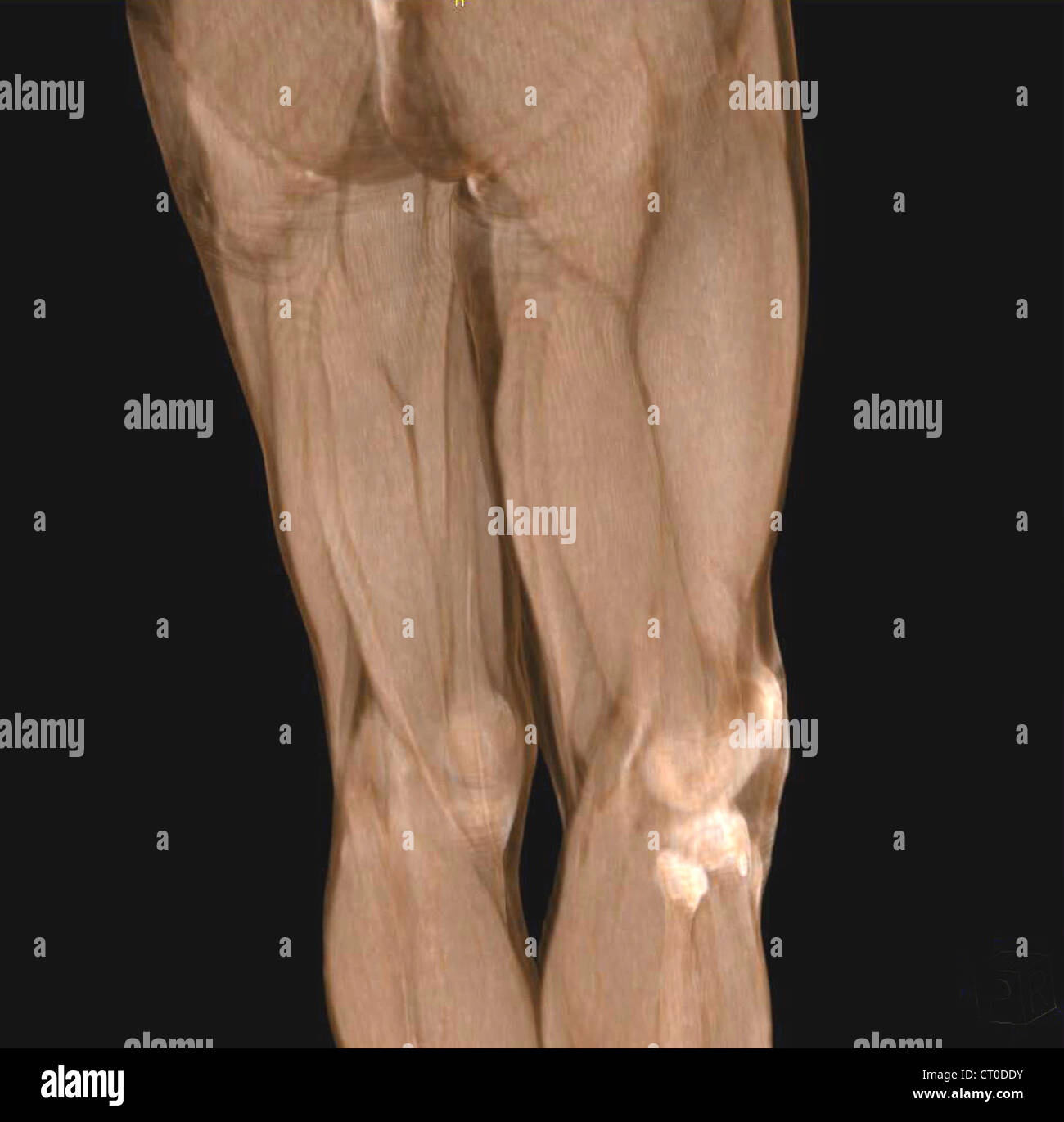 Lower limb 3d scan hi-res stock photography and images - Alamy