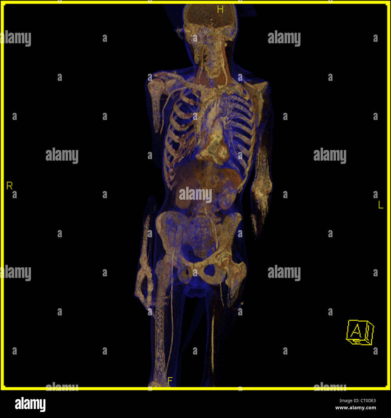 Three skeletal structures hi-res stock photography and images - Alamy