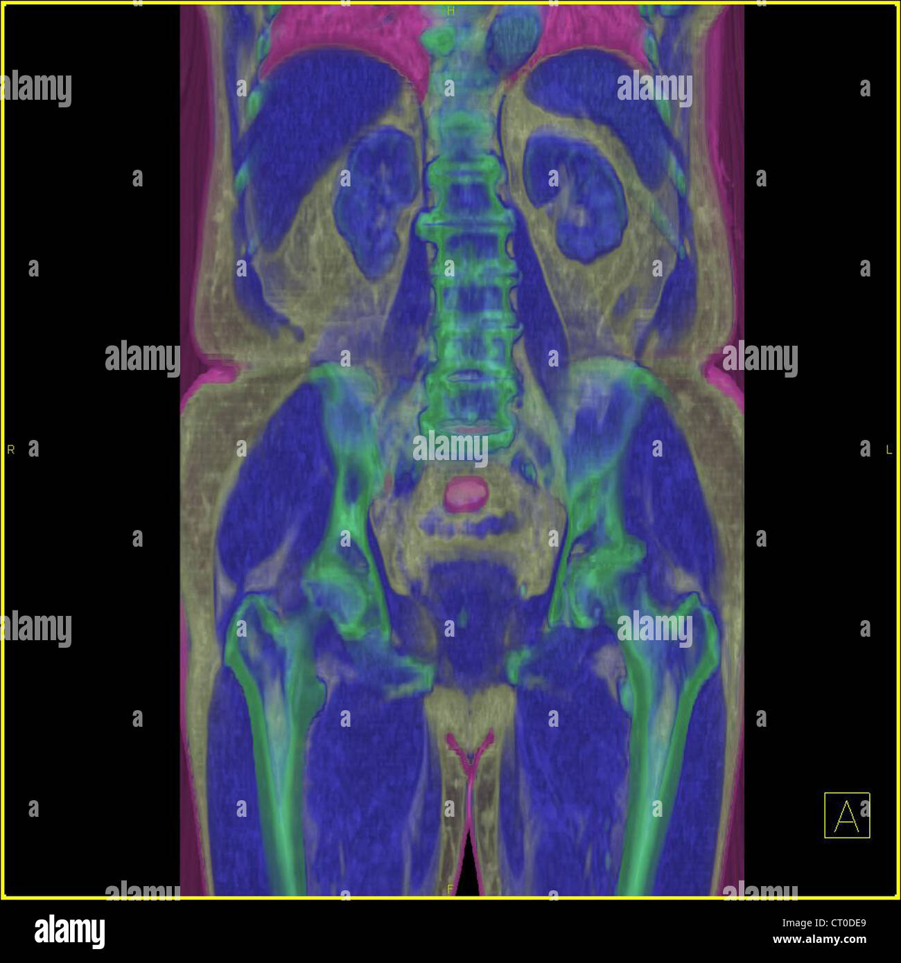 Abdominal structures hi-res stock photography and images - Alamy